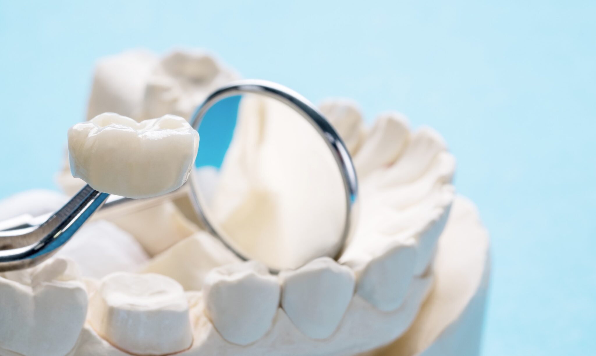 Restorative Dentistry – Mark Milam, DDS